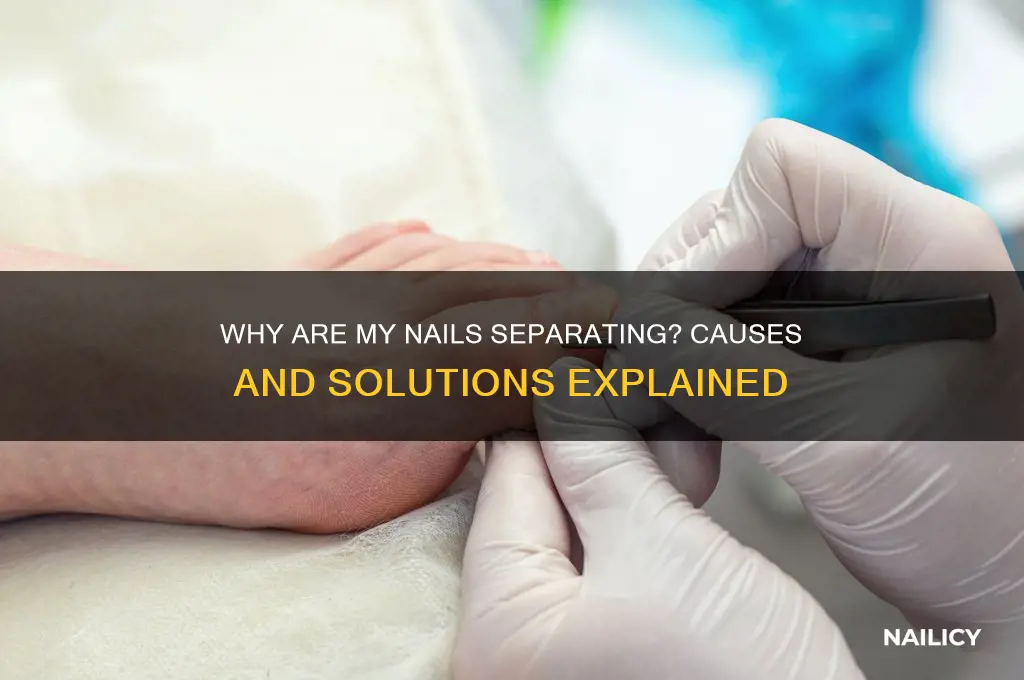 Why Are My Nails Separating? Causes And Solutions Explained | Nailicy