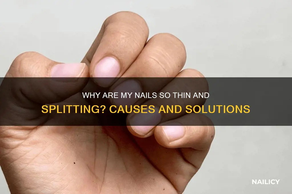 Why Are My Nails So Thin And Splitting? Causes And Solutions | Nailicy