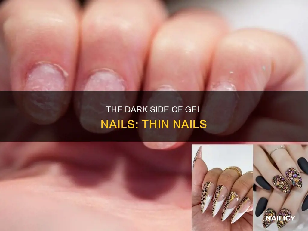 The Dark Side Of Gel Nails: Thin Nails | Nailicy