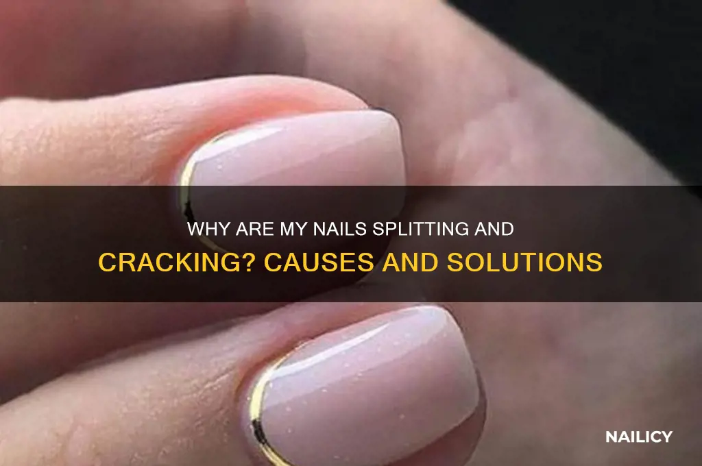 Why Are My Nails Splitting And Cracking? Causes And Solutions | Nailicy