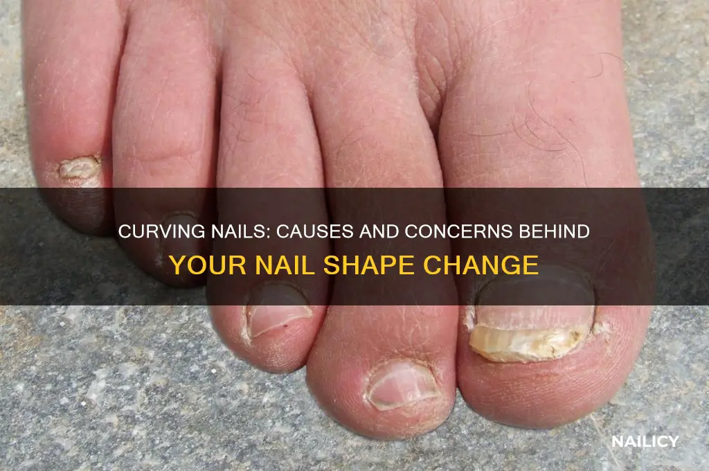 Curving Nails: Causes And Concerns Behind Your Nail Shape Change | Nailicy