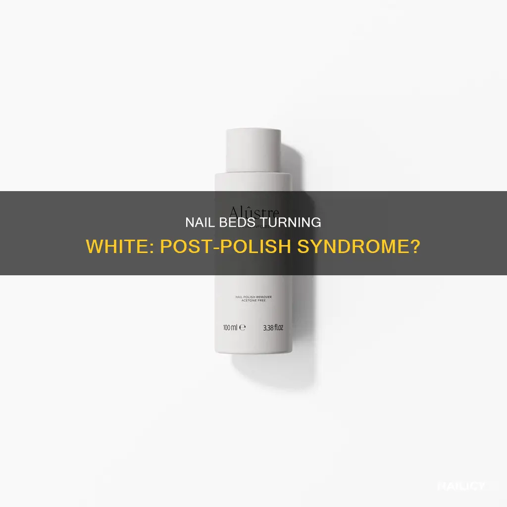Nail Beds Turning White: Post-Polish Syndrome? | Nailicy