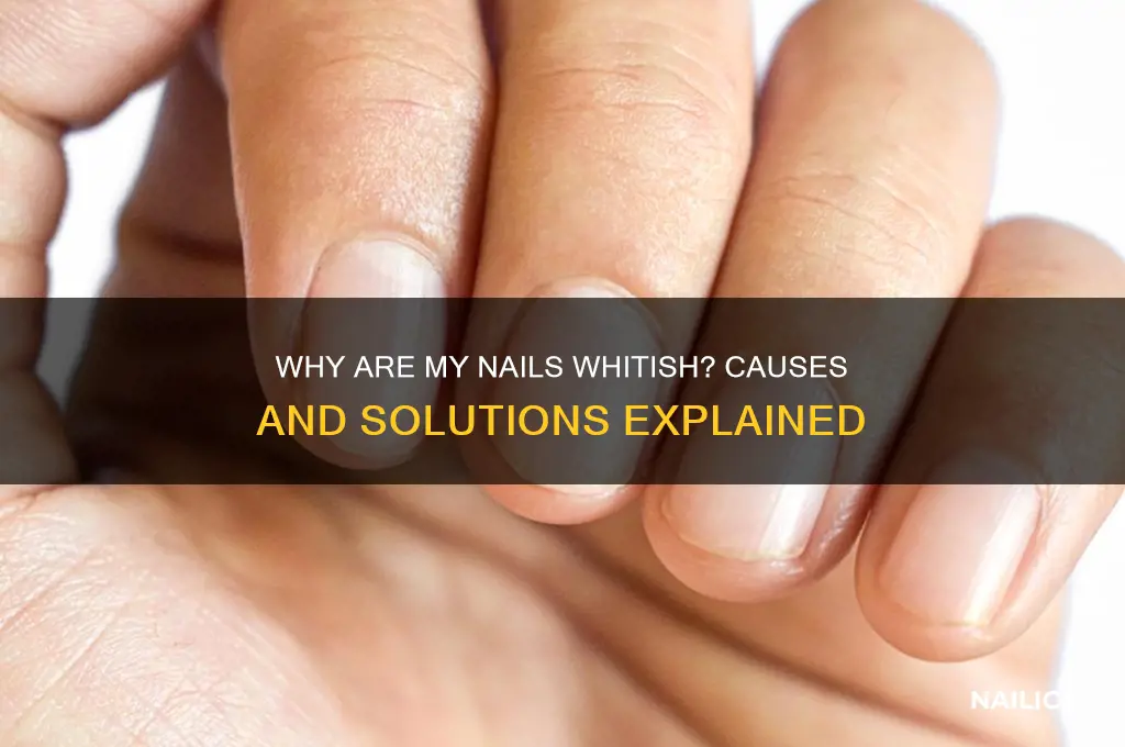 Why Are My Nails Whitish? Causes And Solutions Explained | Nailicy