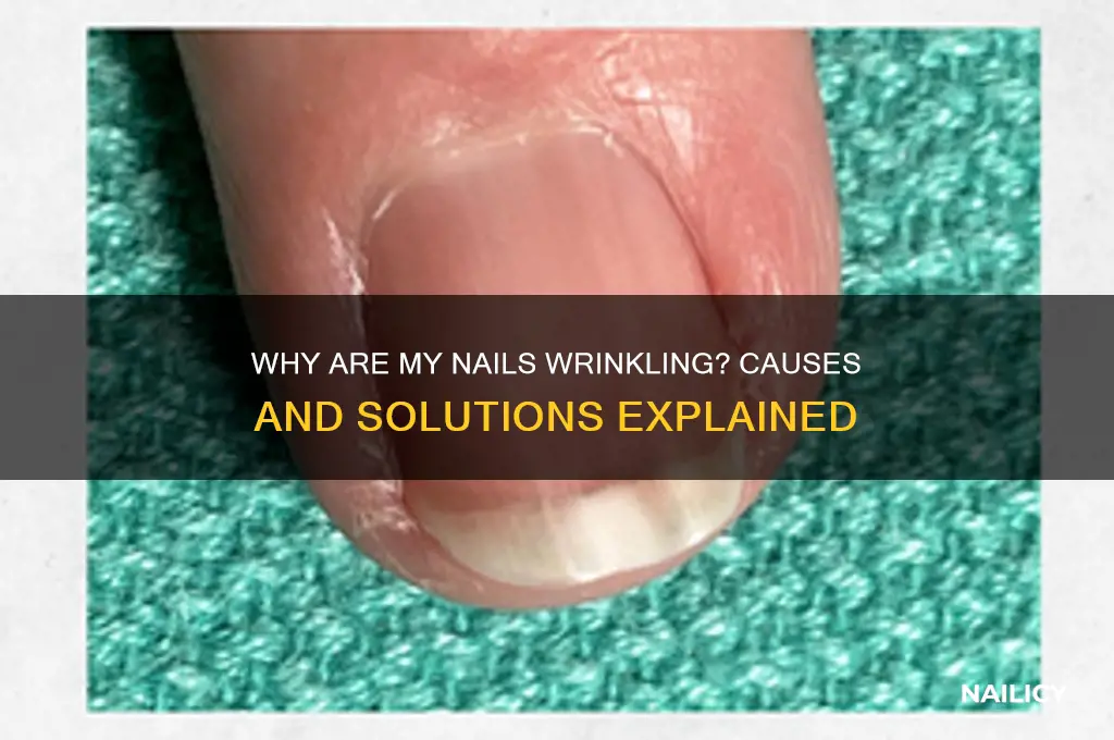 Why Are My Nails Wrinkling? Causes And Solutions Explained | Nailicy