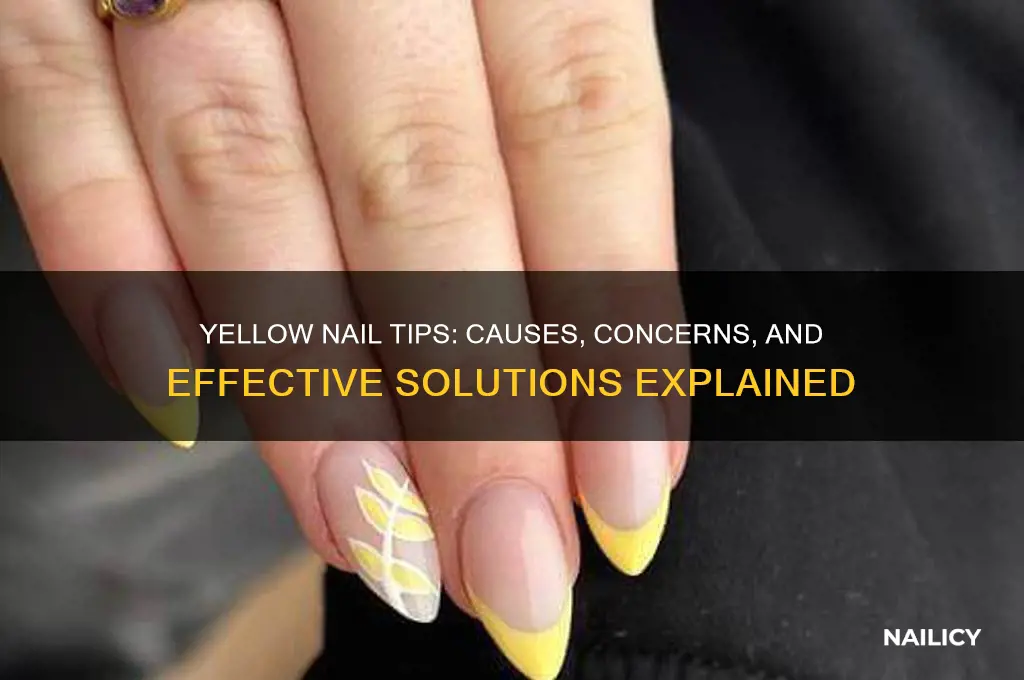 Yellow Nail Tips: Causes, Concerns, And Effective Solutions Explained ...