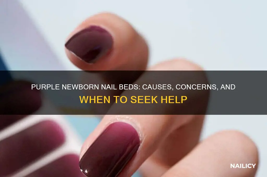 Purple Newborn Nail Beds: Causes, Concerns, And When To Seek Help | Nailicy