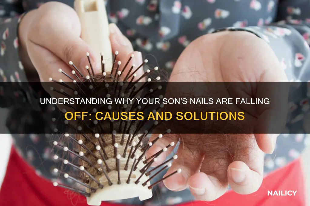 Understanding Why Your Son's Nails Are Falling Off: Causes And ...