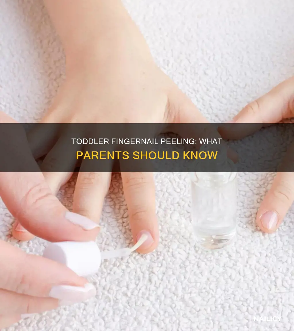 Toddler Fingernail Peeling: What Parents Should Know | Nailicy