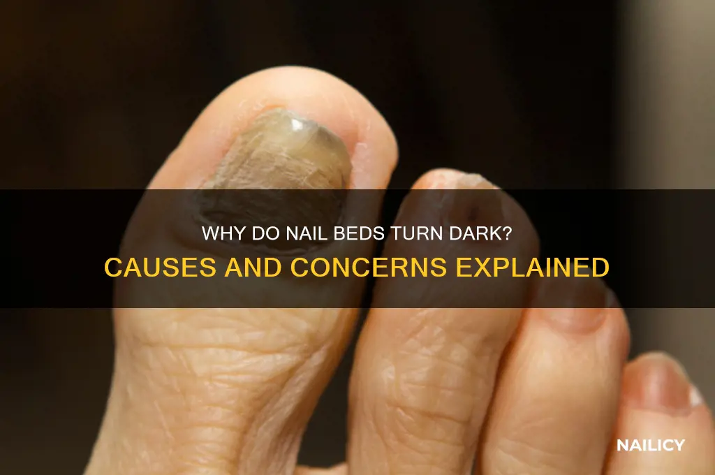 Why Do Nail Beds Turn Dark? Causes And Concerns Explained | Nailicy