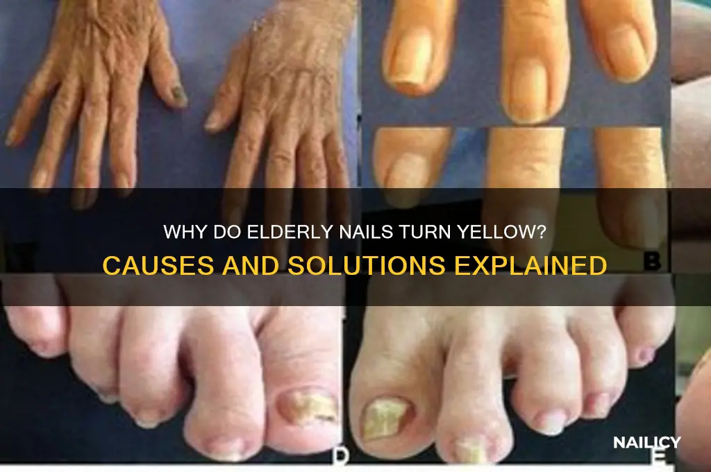 Why Do Elderly Nails Turn Yellow? Causes And Solutions Explained | Nailicy