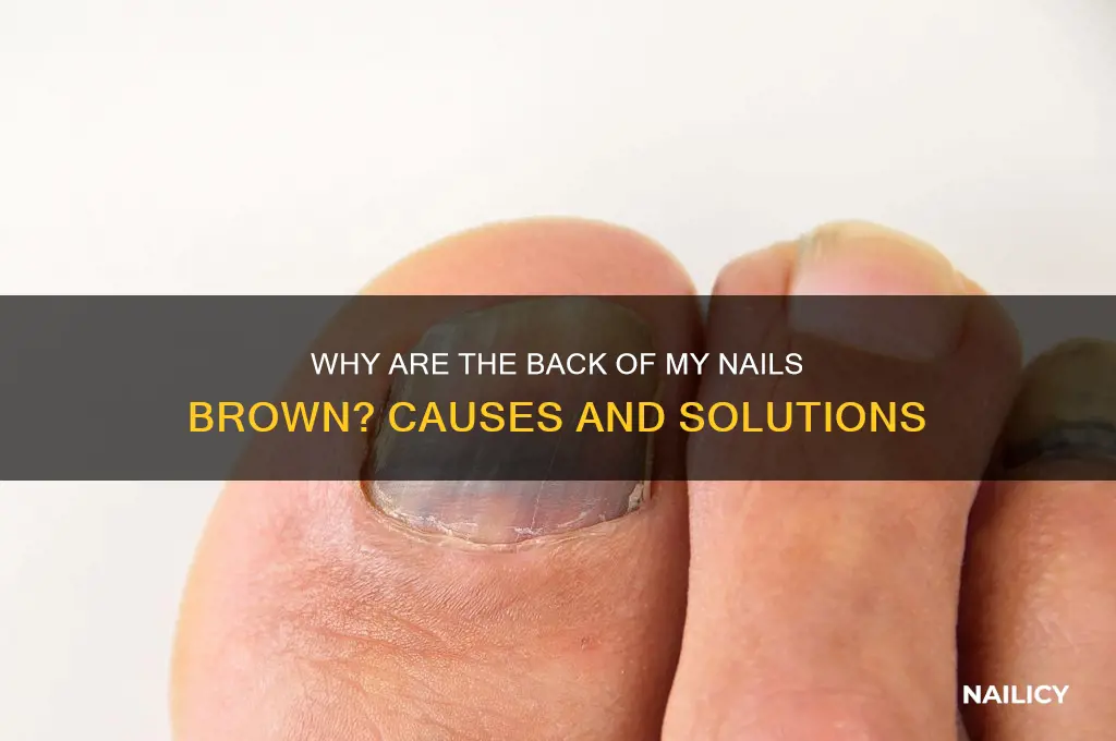 Why Are The Back Of My Nails Brown? Causes And Solutions | Nailicy