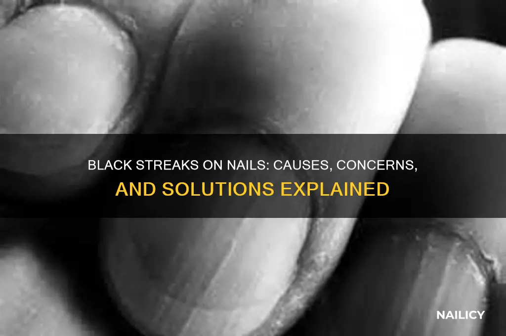 Black Streaks On Nails: Causes, Concerns, And Solutions Explained | Nailicy