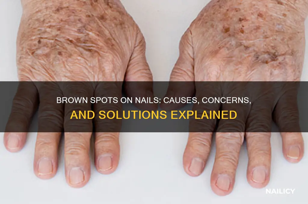 Brown Spots On Nails: Causes, Concerns, And Solutions Explained | Nailicy