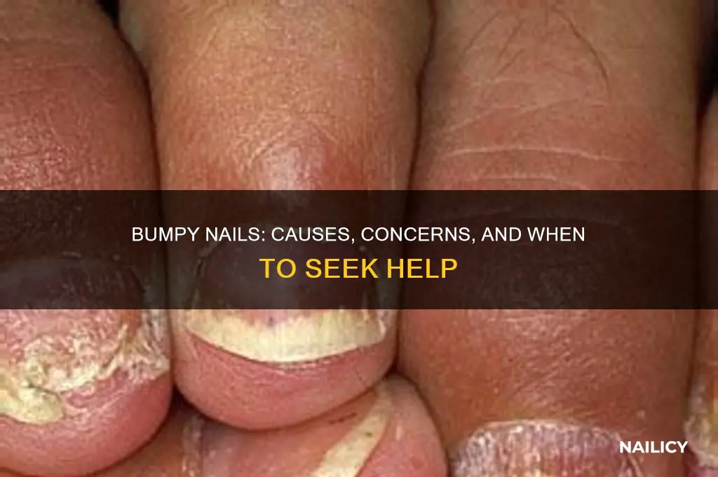 Bumpy Nails: Causes, Concerns, And When To Seek Help | Nailicy