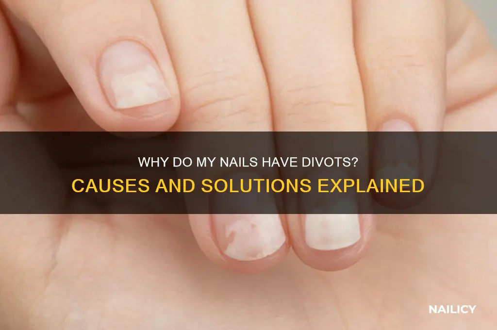 Why Do My Nails Have Divots? Causes And Solutions Explained | Nailicy