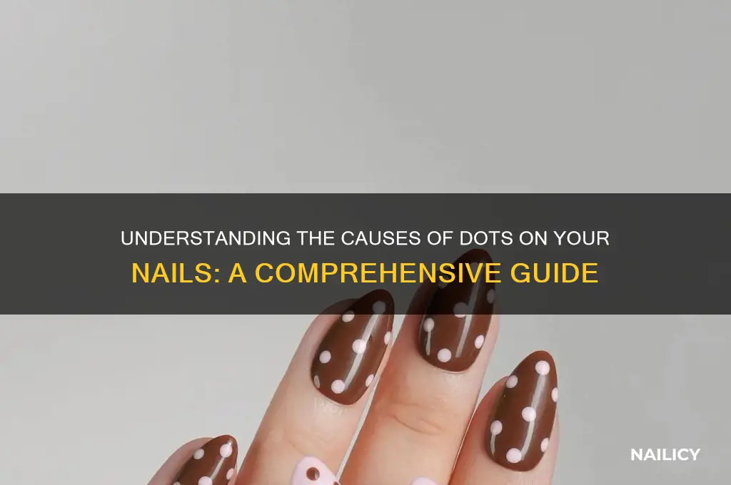 Understanding The Causes Of Dots On Your Nails: A Comprehensive Guide ...