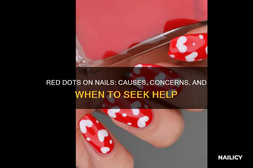 Red Dots On Nails: Causes, Concerns, And When To Seek Help | Nailicy