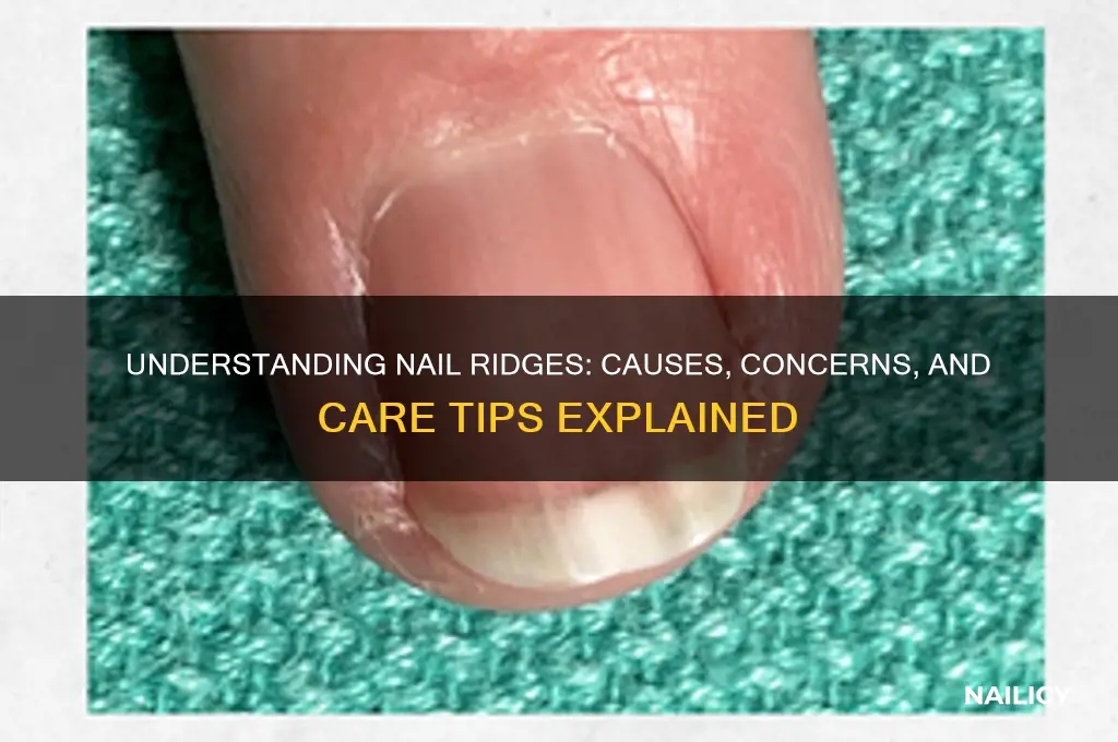 Understanding Nail Ridges: Causes, Concerns, And Care Tips Explained ...