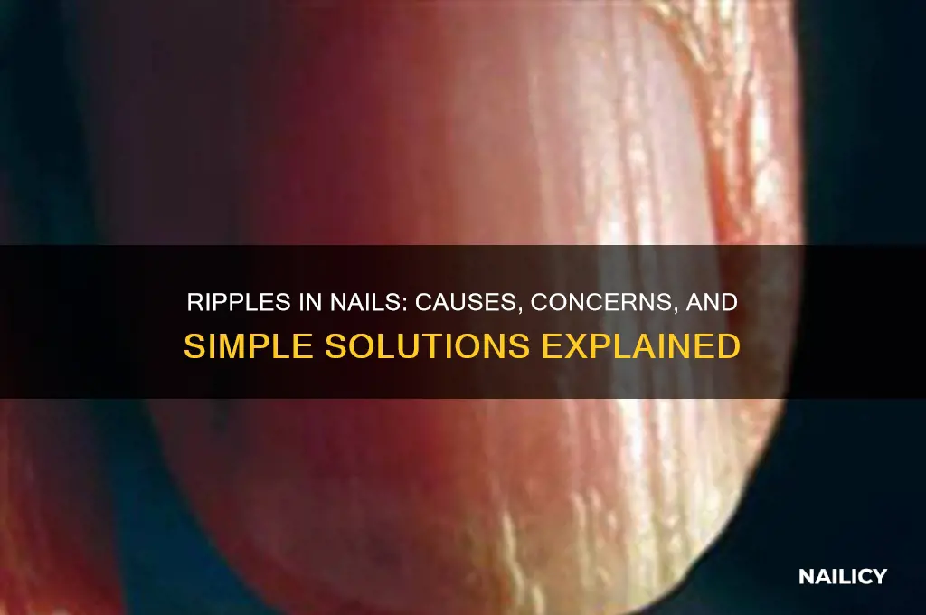Ripples In Nails: Causes, Concerns, And Simple Solutions Explained ...