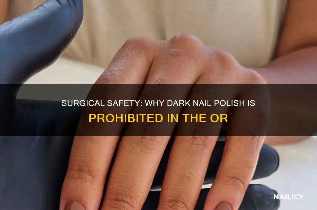 Surgical Safety: Why Dark Nail Polish Is Prohibited In The Or | Nailicy