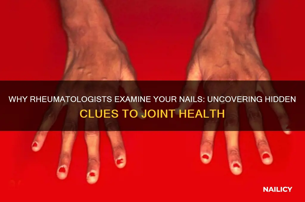 Why Rheumatologists Examine Your Nails: Uncovering Hidden Clues To ...