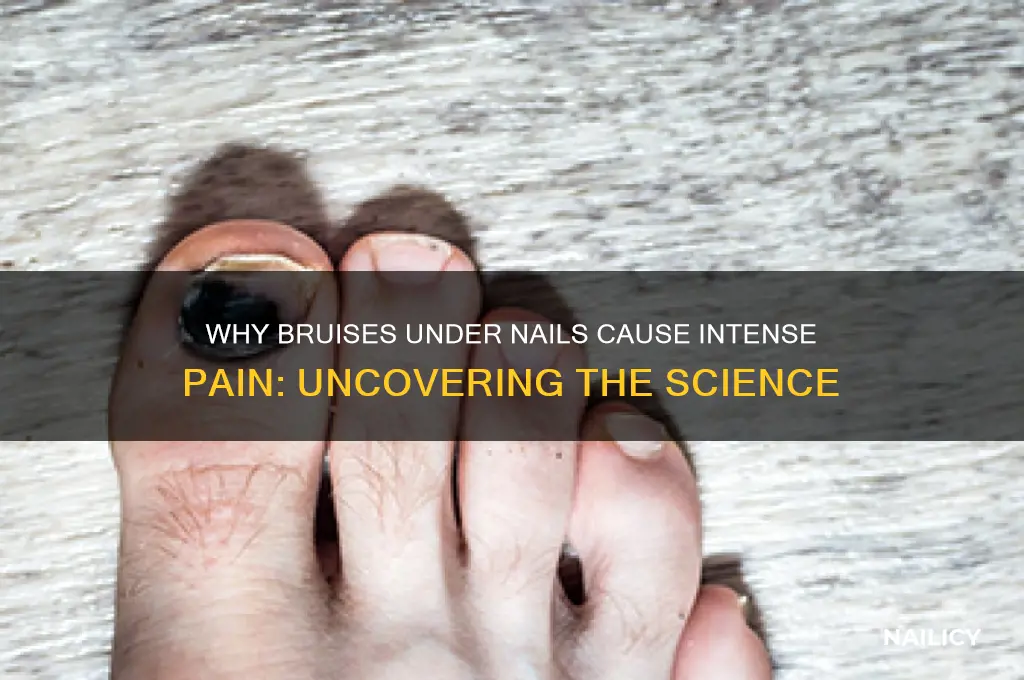 Why Bruises Under Nails Cause Intense Pain: Uncovering The Science ...