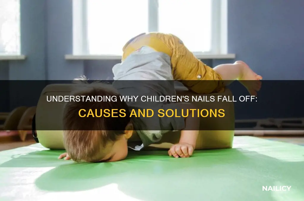 Understanding Why Children's Nails Fall Off: Causes And Solutions | Nailicy