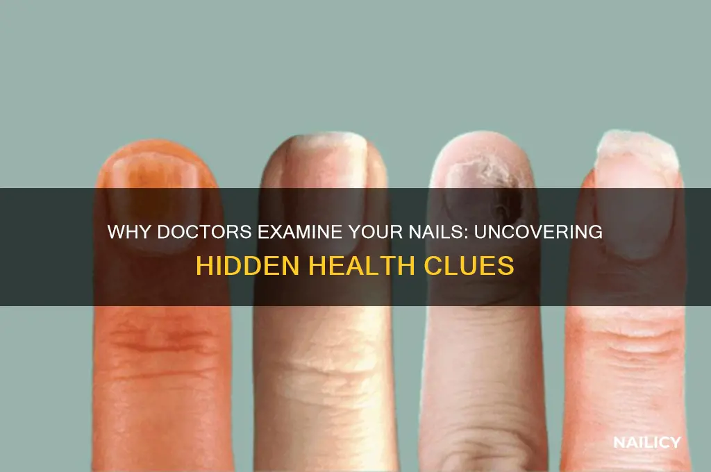 Why Doctors Examine Your Nails: Uncovering Hidden Health Clues | Nailicy