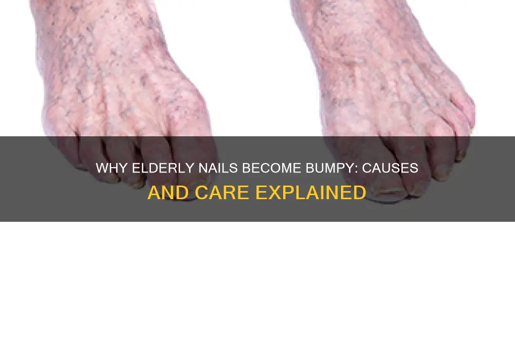 Why Elderly Nails Become Bumpy: Causes And Care Explained | Nailicy