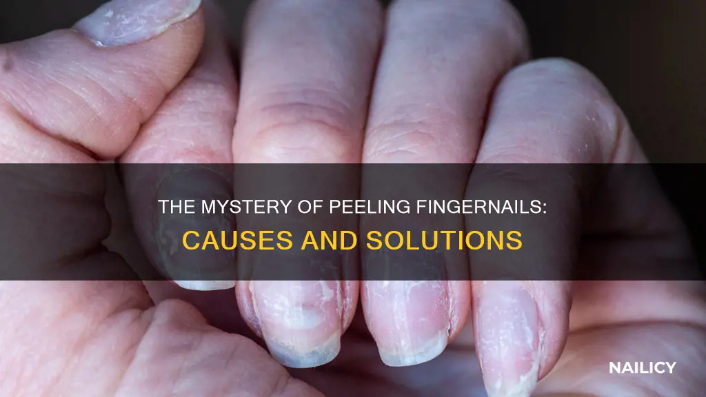 The Mystery Of Peeling Fingernails: Causes And Solutions | Nailicy