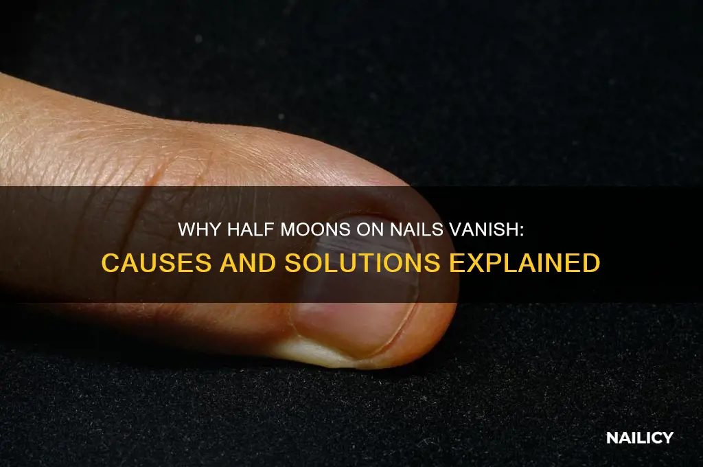 Why Half Moons On Nails Vanish: Causes And Solutions Explained | Nailicy