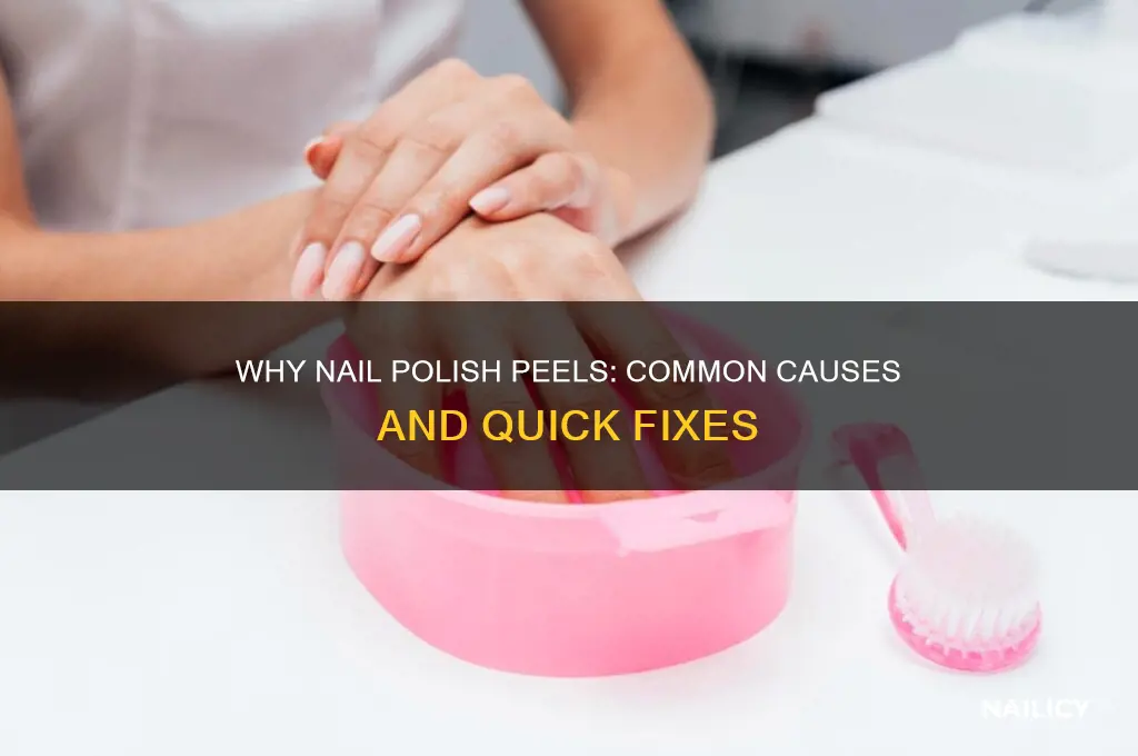 Why Nail Polish Peels: Common Causes And Quick Fixes | Nailicy