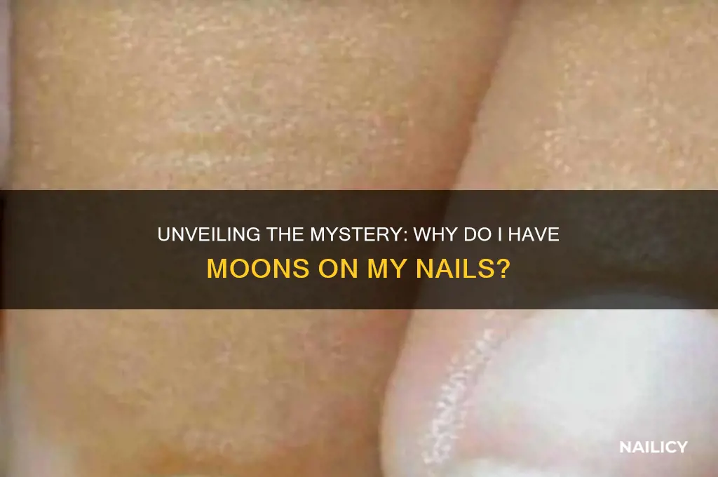 Unveiling The Mystery: Why Do I Have Moons On My Nails? | Nailicy
