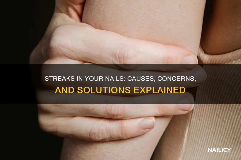 Streaks In Your Nails: Causes, Concerns, And Solutions Explained | Nailicy