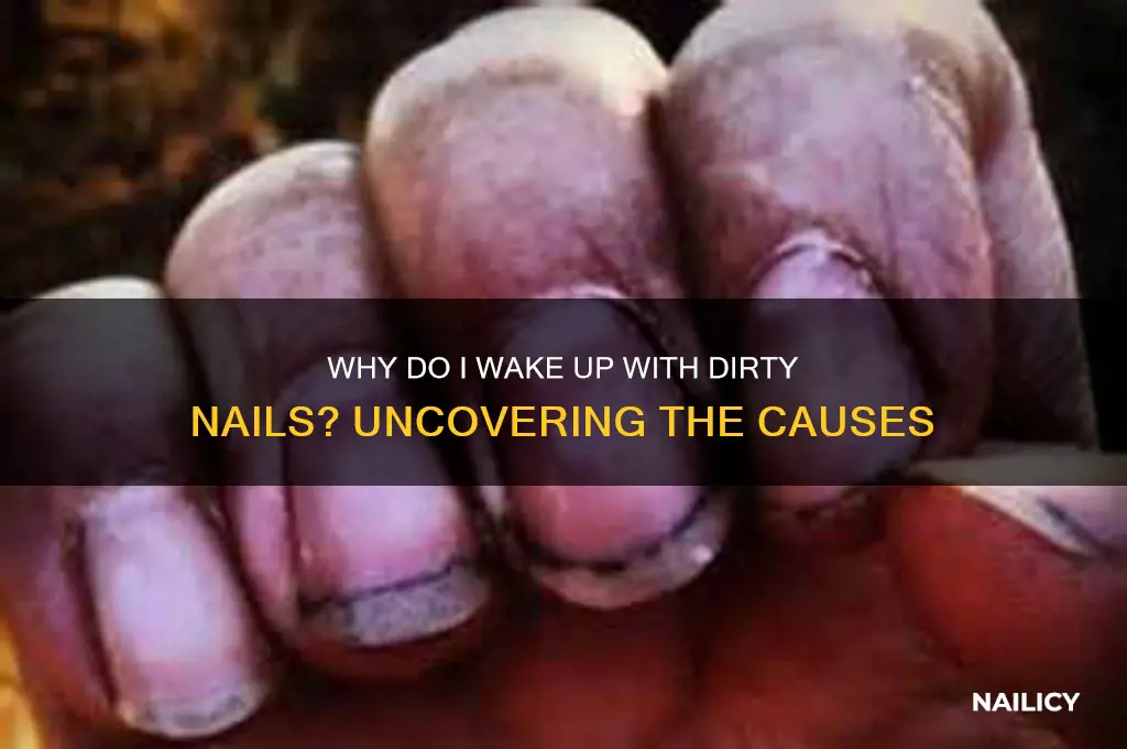 Why Do I Wake Up With Dirty Nails? Uncovering The Causes | Nailicy