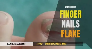Fingernails Falling Off: What Your Body Is Trying To Tell You | Nailicy