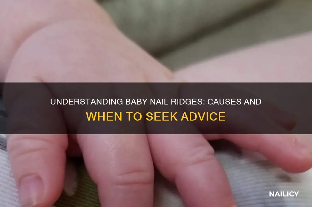 Understanding Baby Nail Ridges: Causes And When To Seek Advice | Nailicy