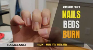Fingernails Falling Off: What Your Body Is Trying To Tell You | Nailicy