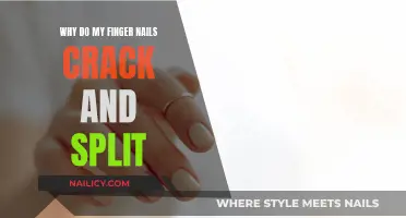 Fingernails Falling Off: What Your Body Is Trying To Tell You | Nailicy