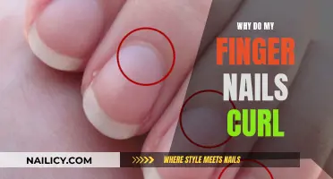 Fingernails Falling Off: What Your Body Is Trying To Tell You | Nailicy