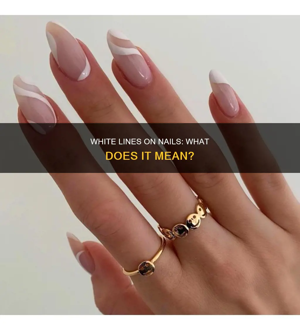 White Lines On Nails: What Does It Mean? | Nailicy