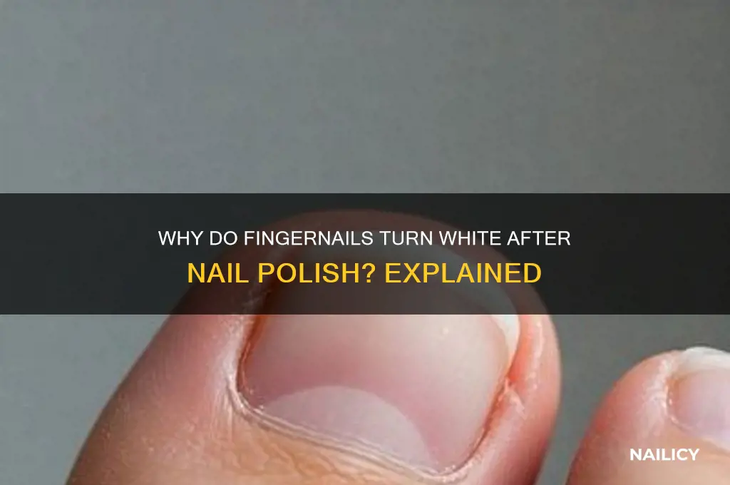 Why Do Fingernails Turn White After Nail Polish? Explained | Nailicy