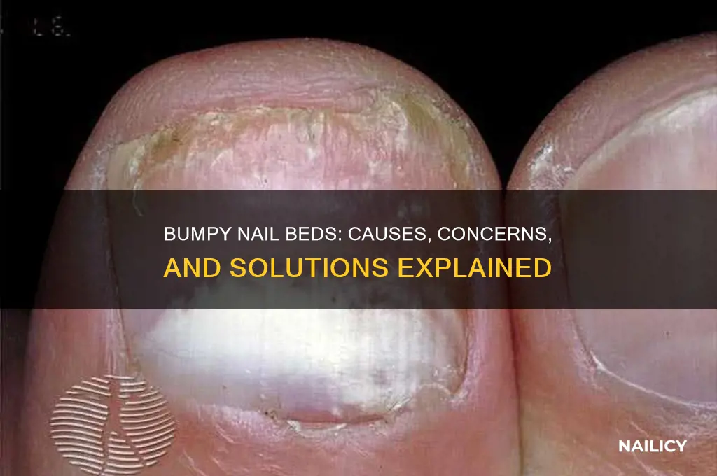 Bumpy Nail Beds: Causes, Concerns, And Solutions Explained | Nailicy