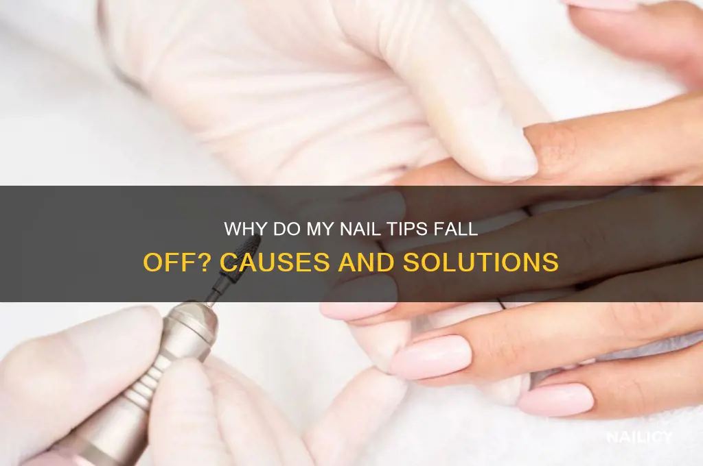 Why Do My Nail Tips Fall Off? Causes And Solutions | Nailicy