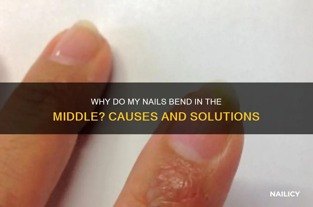 Why Do My Nails Bend In The Middle? Causes And Solutions | Nailicy