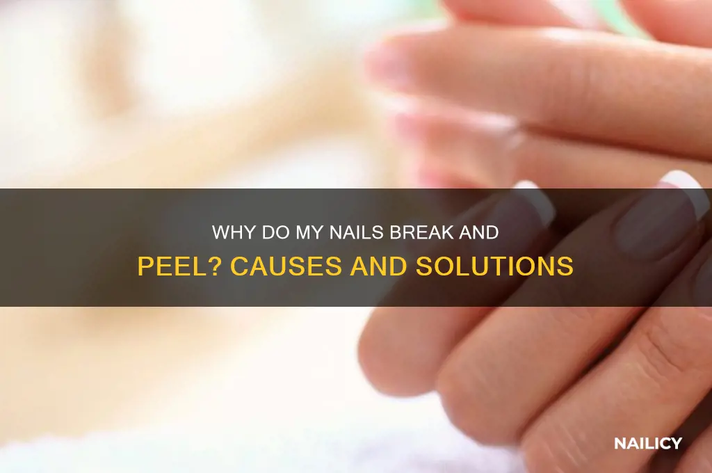 Why Do My Nails Break And Peel? Causes And Solutions | Nailicy