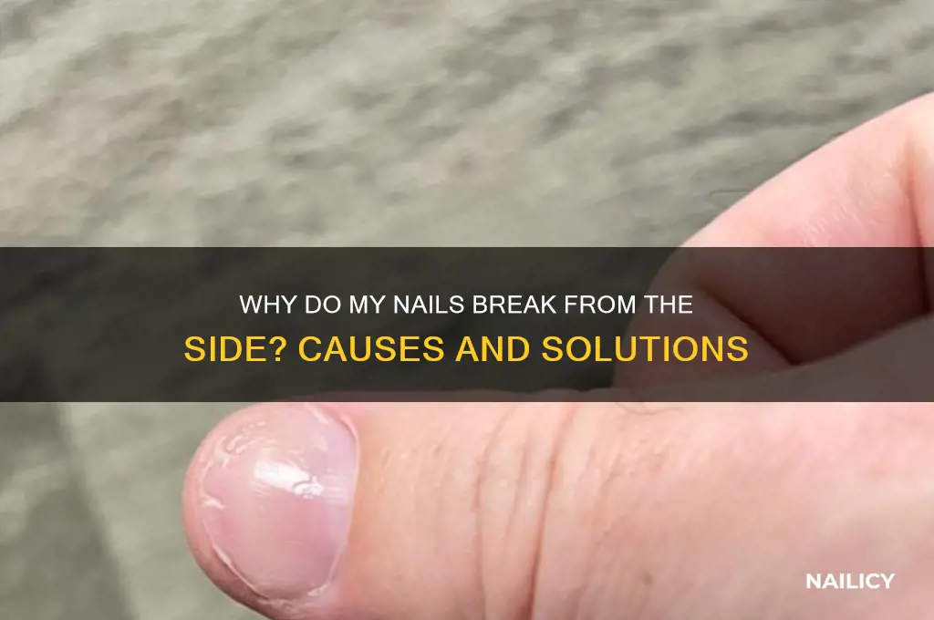 Why Do My Nails Break From The Side? Causes And Solutions | Nailicy
