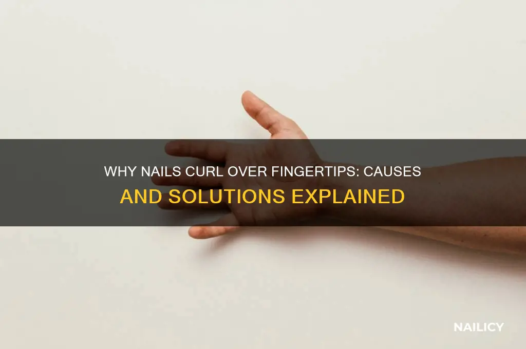 Why Nails Curl Over Fingertips: Causes And Solutions Explained | Nailicy