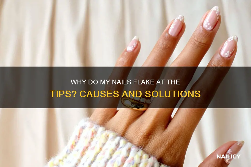 Why Do My Nails Flake At The Tips? Causes And Solutions | Nailicy