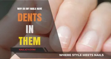 Why Is There A Dent In My Nail? Causes And Concerns | Nailicy